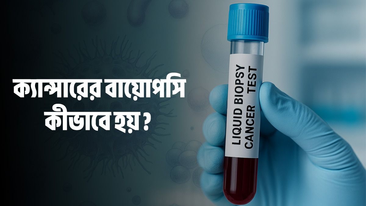 Cancer biopsy detection Liquid Bio - Liquid Biopsy: লিক্যুইড বায়োপসি কীভাবে হয়- কতটা ...