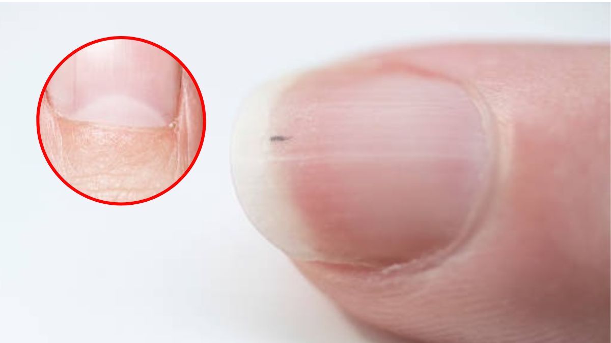 नाखून पर ये अर्ध चंद्र है इंसान के अमीर होने का संकेत, बस इन लोगों के ...